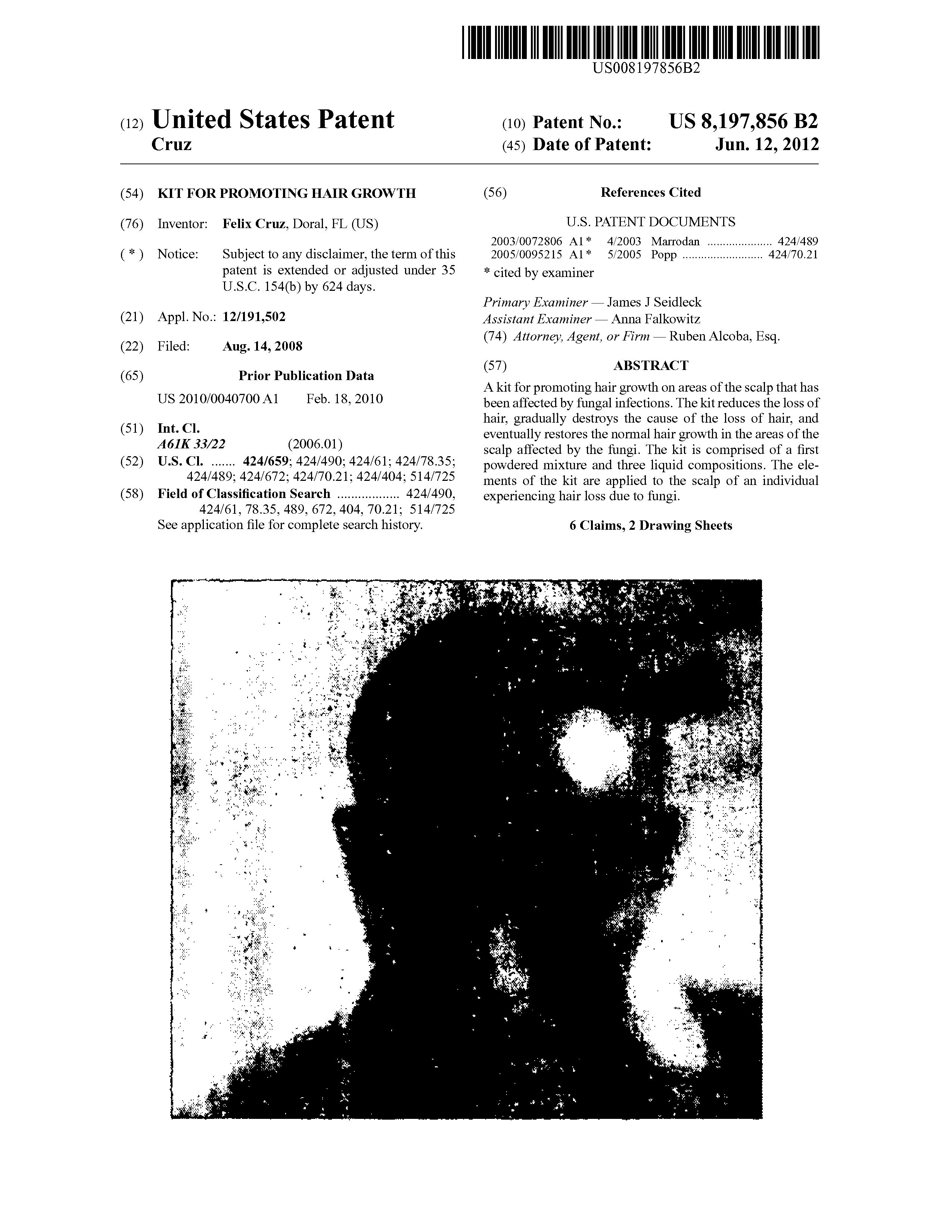 Buy The Patent Kit For Promoting Hair Growth Patent For Sale
